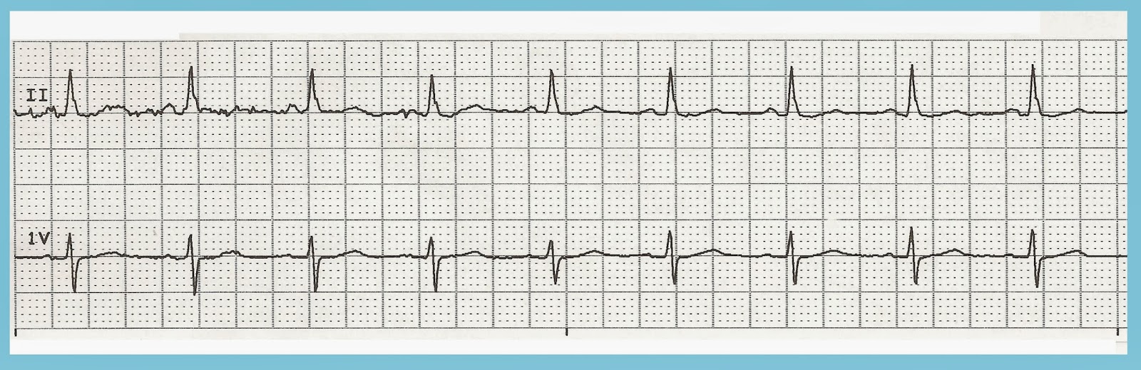 Practice EKG Rhythm Strips 209