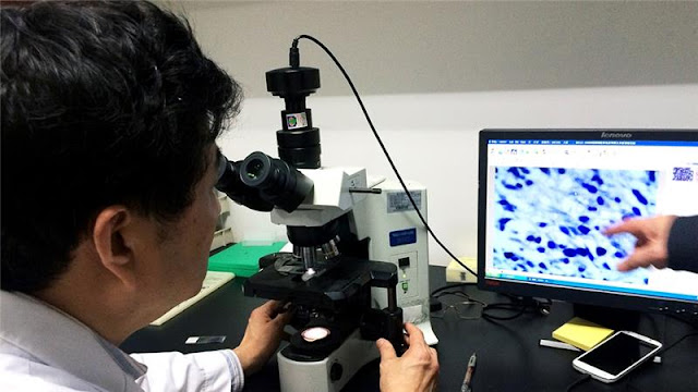 Fuda News: Dr Xu Kecheng wanted to find a way for advanced-stage cancer ...