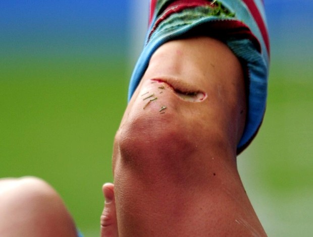 English Football : Side Villa suffers deep cut in his leg after ...