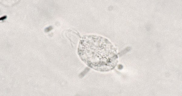 Medical Laboratory and Biomedical Science: New testing options for ...