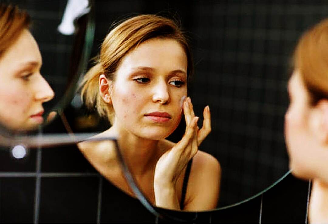 An Easy Way To Prevent Acne How To Prevent Pimples Fastest Way To