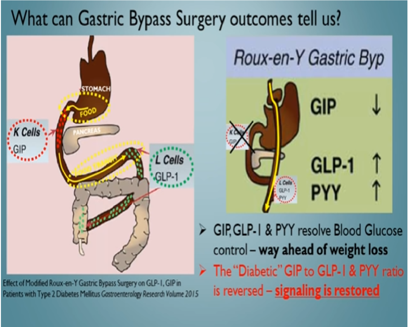 RDO: Gabor Erdosi: on GIP and GLP-1 and harmful effects of processed foods
