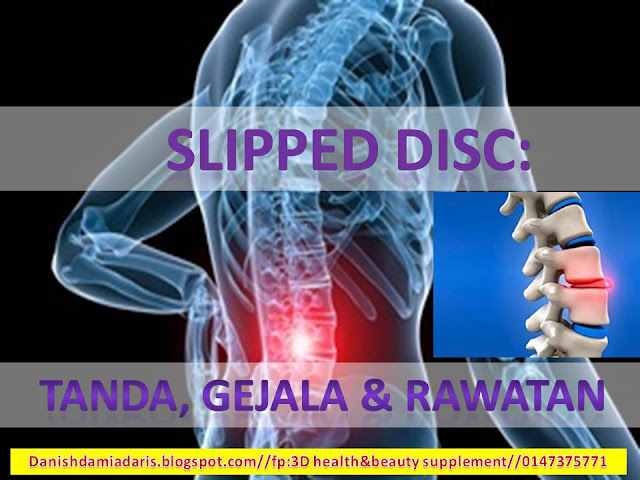 3D health beauty supplement: CAKERA TERGELINCIR @ SLIPPED DISC: APA ...