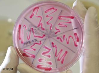 Bakteri Coliform dan E. coli - Rumah Lingkungan dan Kesehatan Indonesia