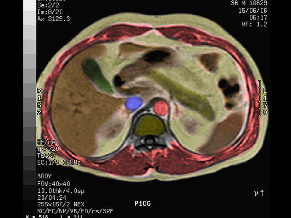 COLANGIO RM: COLANGIO RM