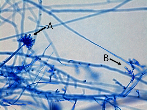 Fun With Microbiology (What's Buggin' You?): Aspergillus versicolor