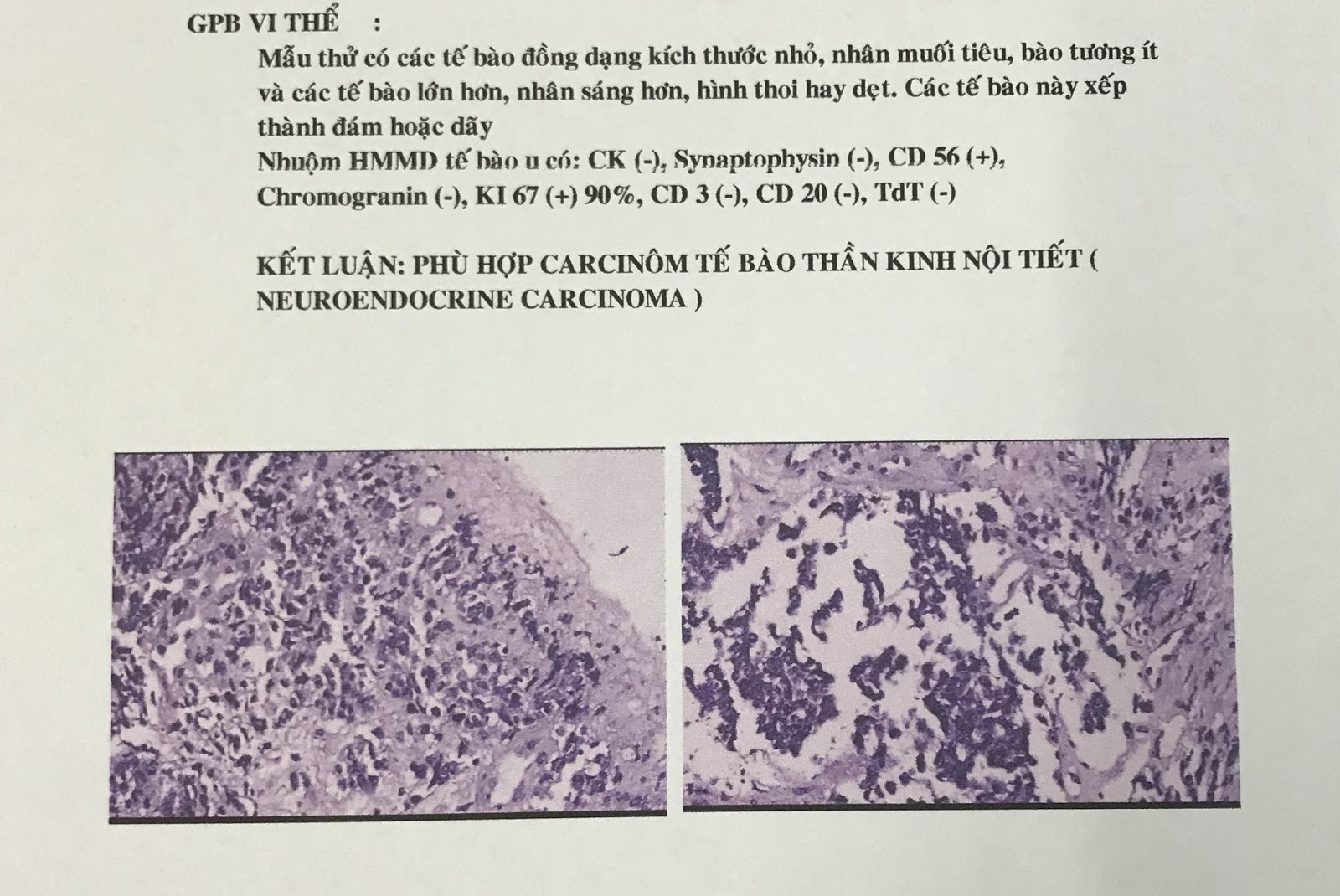 VIETNAMESE MEDIC ULTRASOUND: CASE 470: TROISIER-VIRCHOW NODES, Dr PHAN ...