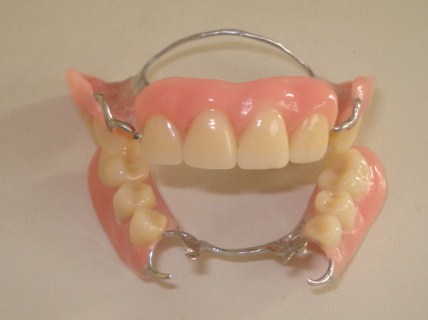 Laprotege: PPR,Prótese Parcial Removível