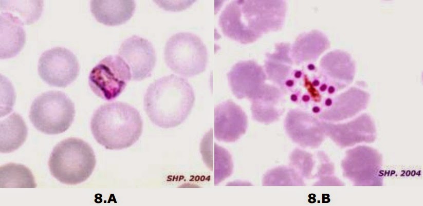 Plasmodium malariae | MedTech
