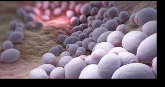 What is the Fungal Disease?