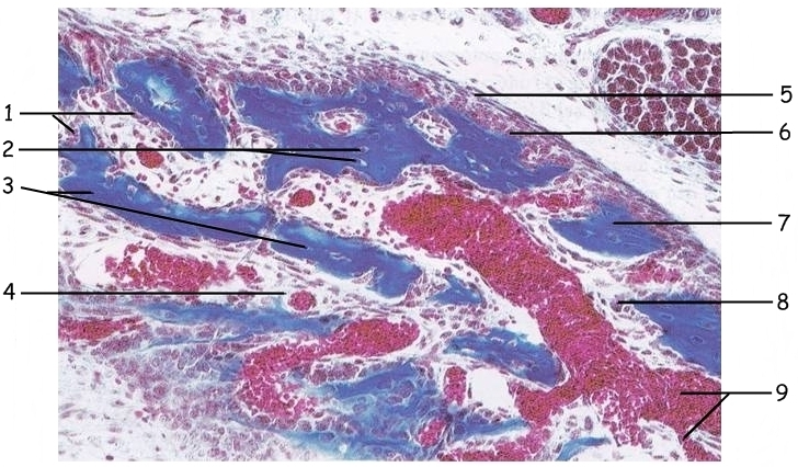 ongko setunggal wibowo: Trigger 6 : Trauma Capitis