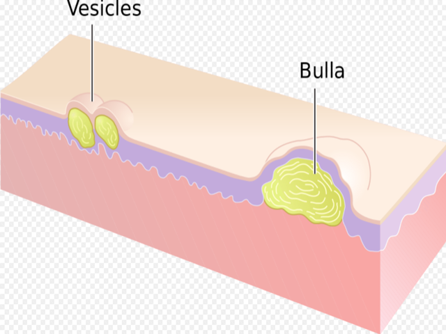 연조직 질환 용어 정리(Macule, patch 등) ~ Healthy Happy
