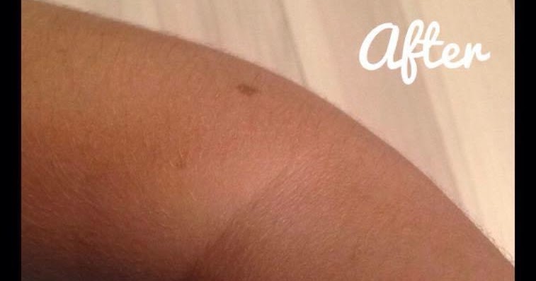 bBold Spray Self Tan Review