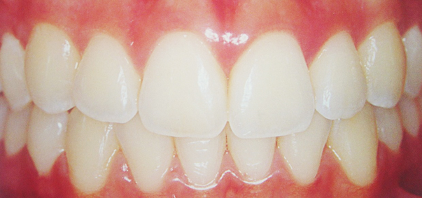 Dentisterie Clínica Odontológica: Doença Periodontal - Parte 2