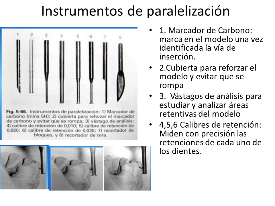 REHABILITACION II : 2°° Parcial PARALELOMETRO