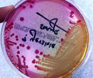 Yersinia (Yersinia enterocolitica,Yersinia pestis) - Microbiology ...