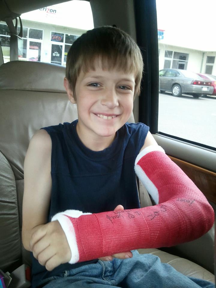 Many in the Manse: Matthew's cast removal