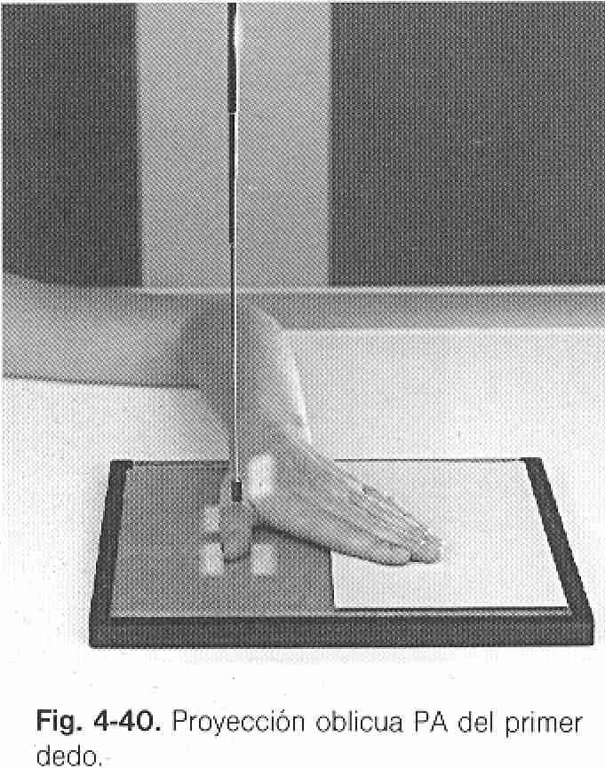 tecradiologos: PRIMER DEDO (PULGAR).