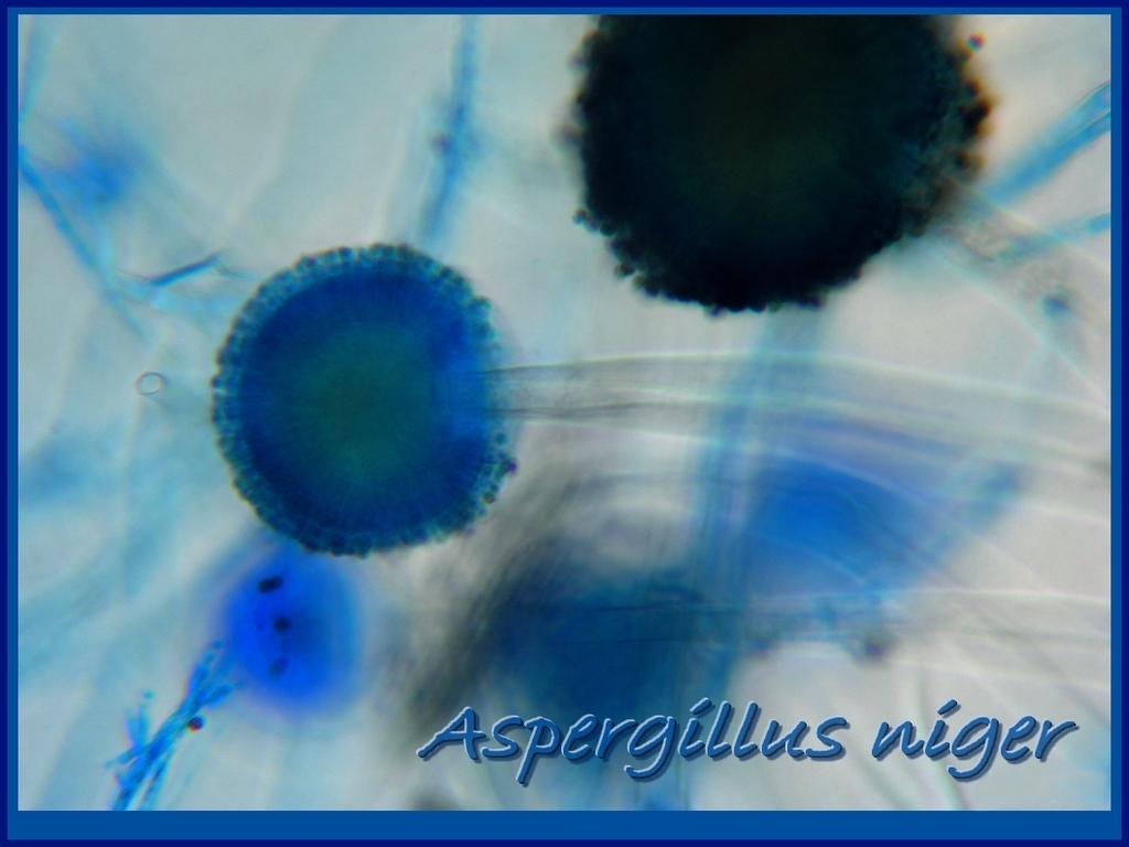 Fun With Microbiology (What's Buggin' You?): Aspergillus niger