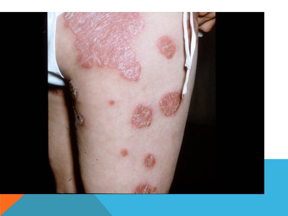 Teaching Dermatology Specialist Trainee Edition