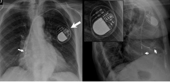 Dr.Nabil Paktin's Cardiology Blog مجله کاردیولوژی دکتور نبــیل پاکطـین ...