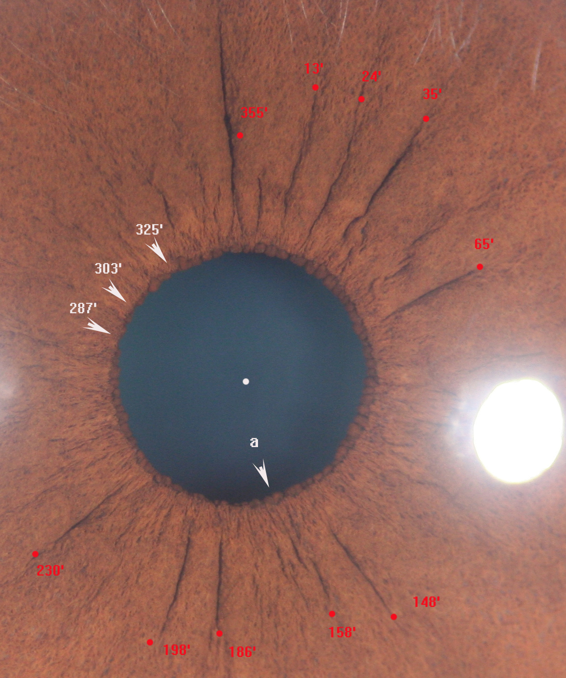 Modern & Multidimensional Iridology: IPB - Morphologies, Space Risk ...
