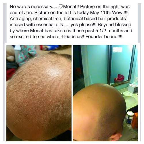 MONAT Global Revolutionary Hair Care Products: Is your hair thinning or ...