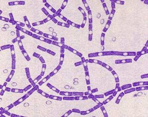 Pengelompokan Bakteri Berdasarkan Bentuk