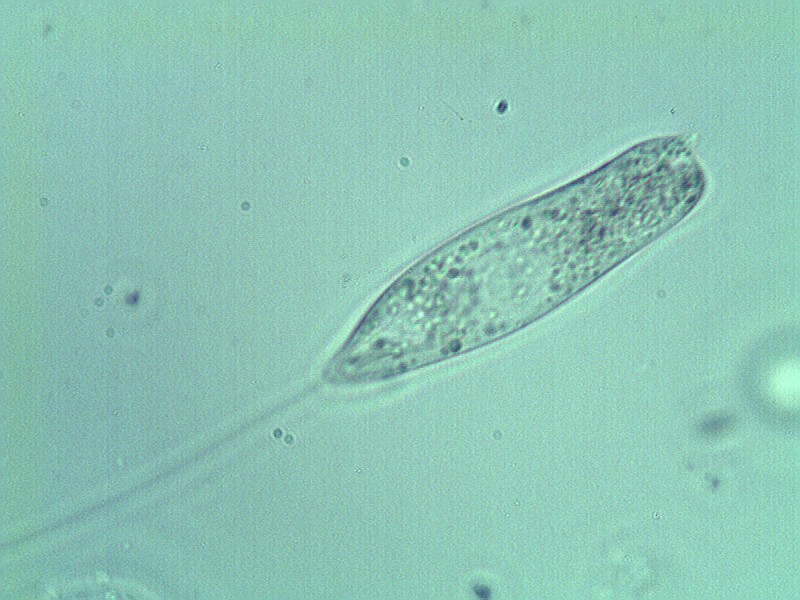 gabylovesbio: phyla of protozoa