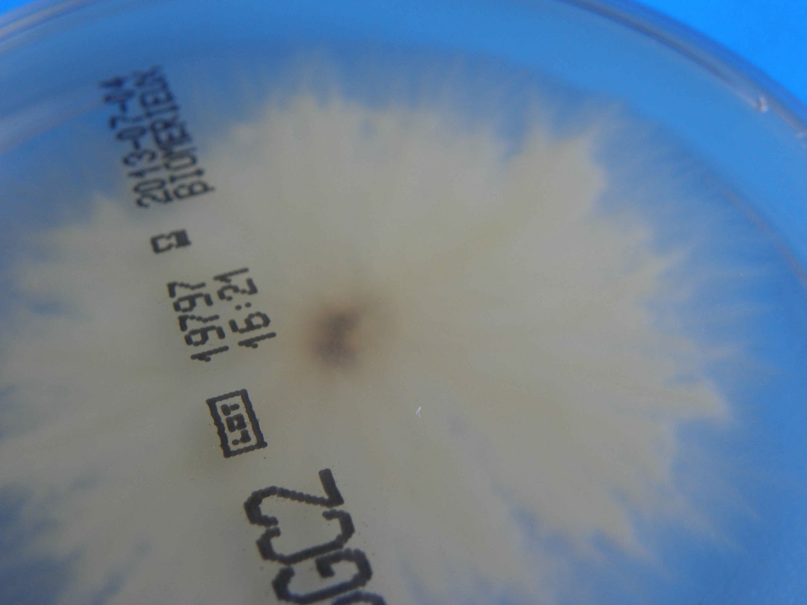 ATLAS MICOLOGIA: MICROSPORUM GYPSEUM