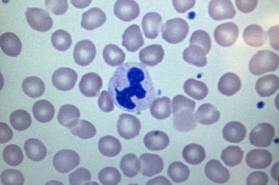 Medical Laboratory and Biomedical Science: Dog People Have Puppy-cells