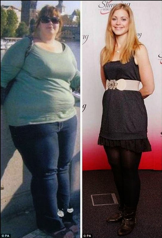 BP: 18 Months in 90 kg weight loss