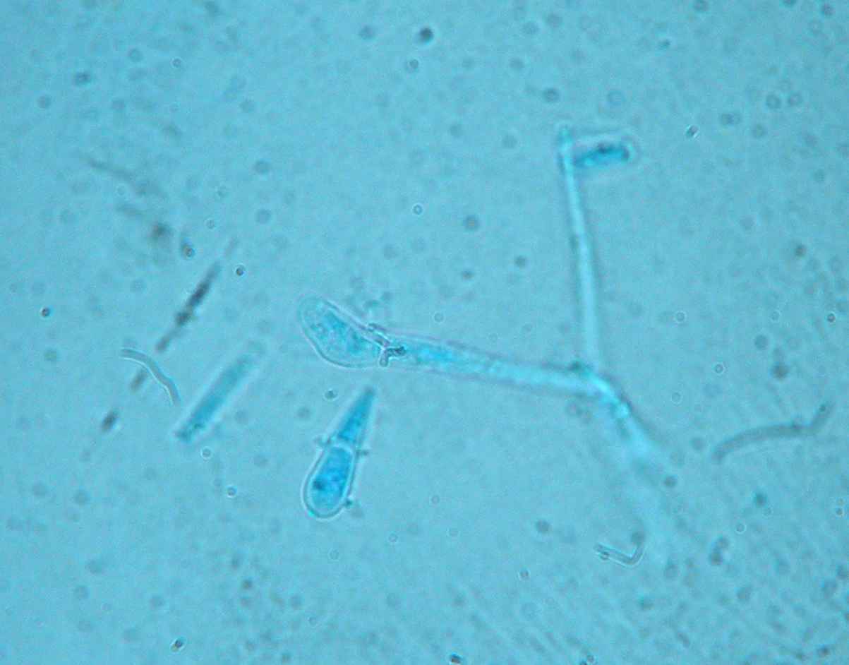 ATLAS MICOLOGIA: EPIDERMOPHYTON FLOCCOSUM