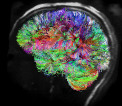 Exames de ressonância