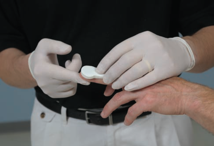 Pertolongan Pertama pada Patah Tulang Jari