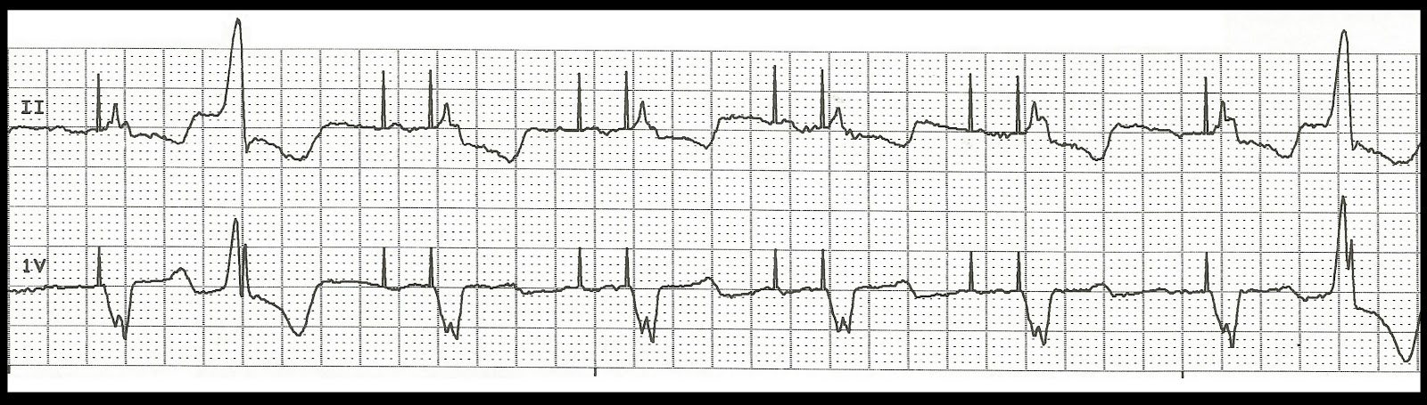 Practice EKG Rhythm Strips 153