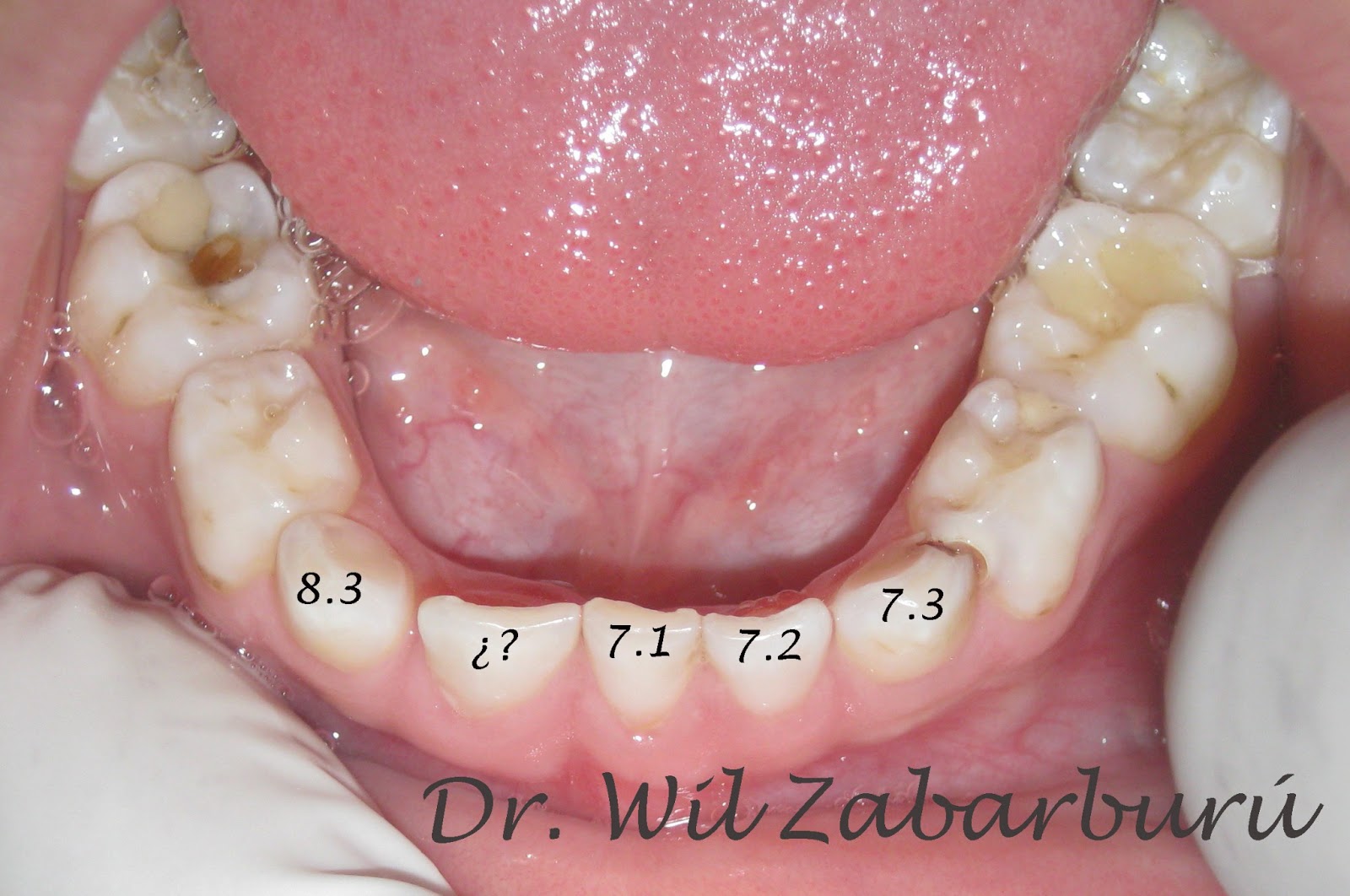 CLINICA DENTAL ASISTENCIAL: FUSIÓN DENTAL