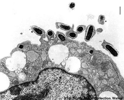 Infection Landscapes: The Rickettsial Diseases