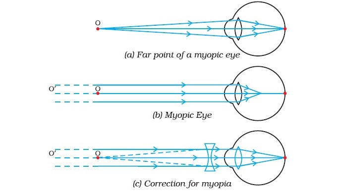 science: CLASS X :HUMAN EYE AND THE COLOURFUL WORLD