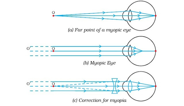 science: CLASS X :HUMAN EYE AND THE COLOURFUL WORLD
