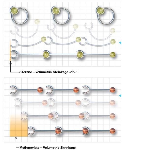 Wizdent Silorane Composites