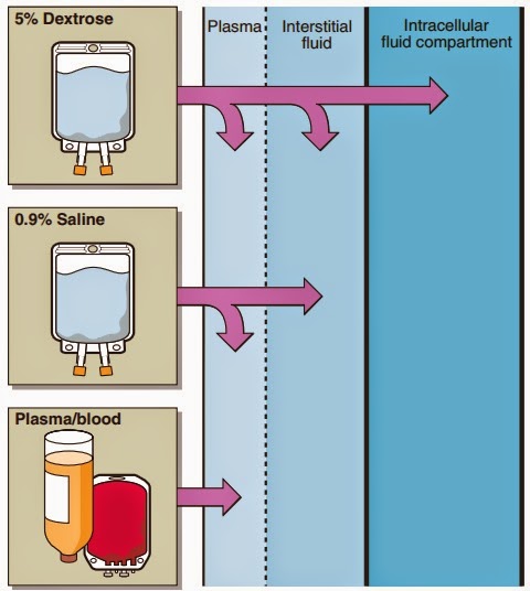 Intravenous fluid therapy | Tuyenlab