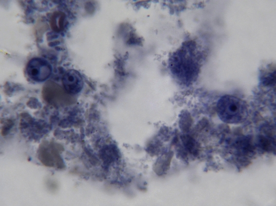 Fun With Microbiology (What's Buggin' You?): Iodamoeba bütschlii