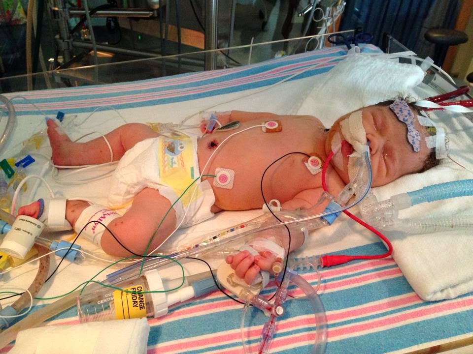 Our CDH Journey: Oh ECMO