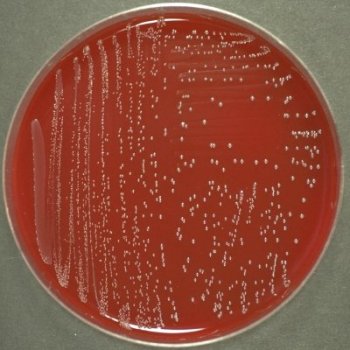 I.BETA-HAEMOLYTIC STREPTOCOCCI | All Microbes