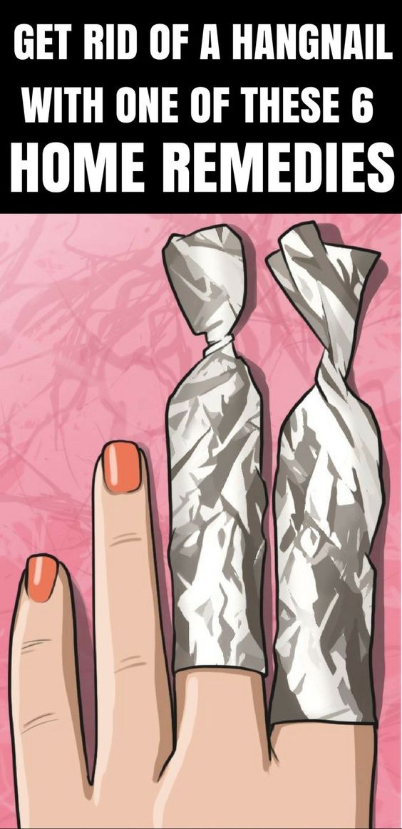 Get Rid Of A Hangnail & 1 Of These 6 Home Remedies!!! - healthymasters