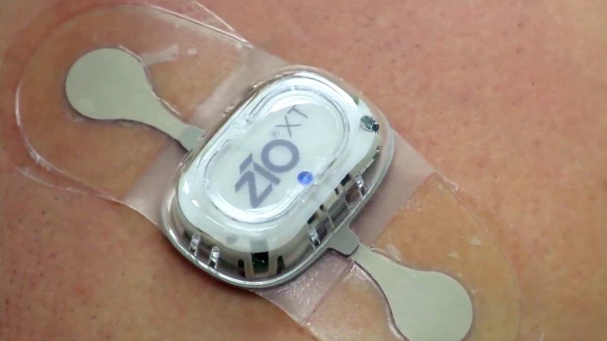 Machine Learning In Detection Of Heart Arrhythmias