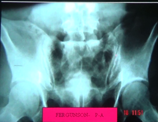 RADIOANATOMIA: CLASE 9