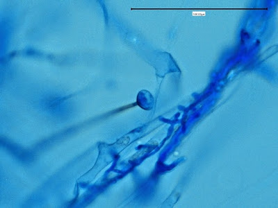 Fun With Microbiology (What's Buggin' You?): Apophysomyces elegans ...