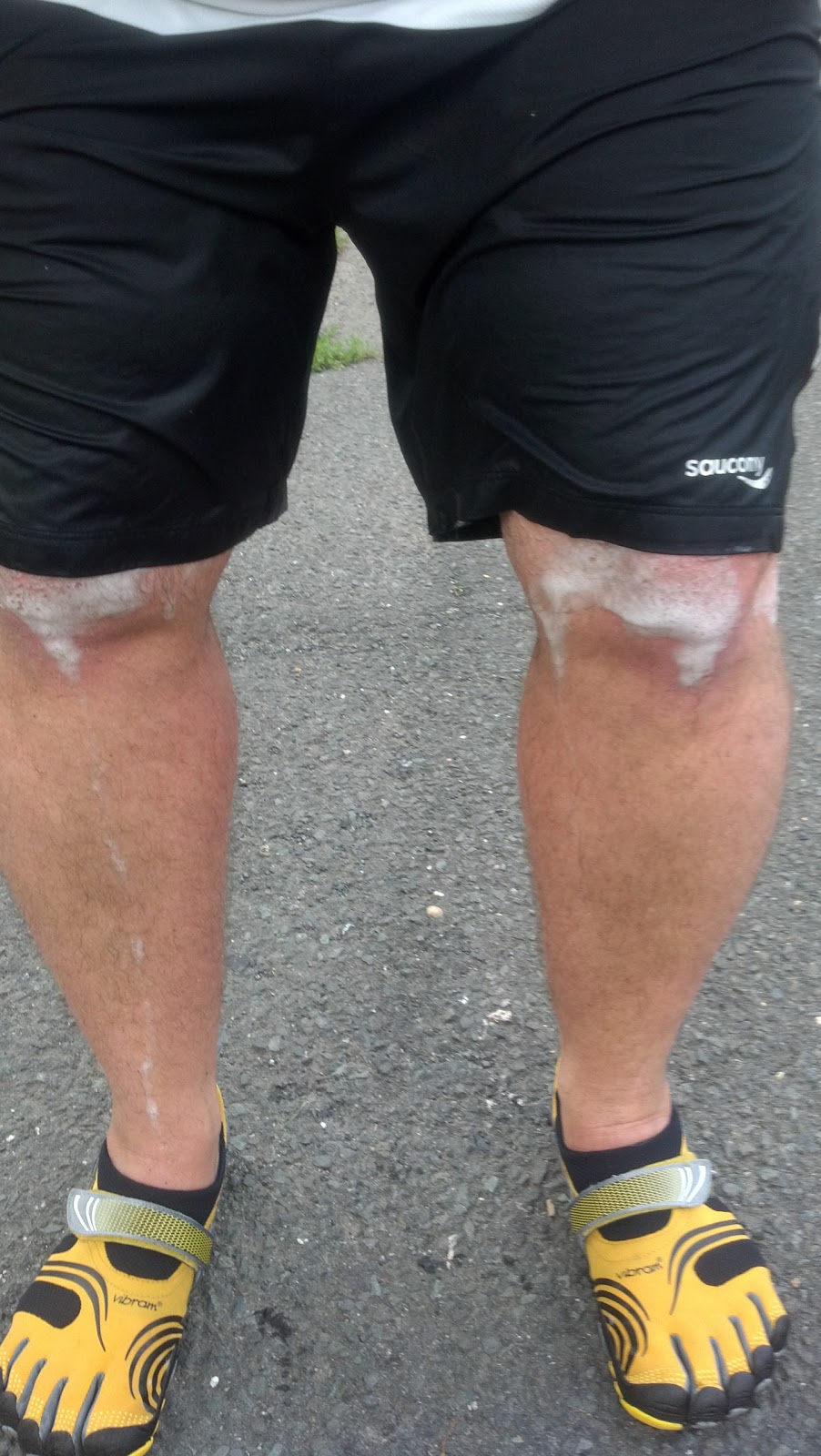 The Foam Incident | Blubber to Runner - My Quest to Total Health
